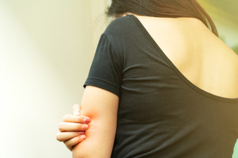 Atopická dermatitida (ekzém) | Bioklinika Ostrava